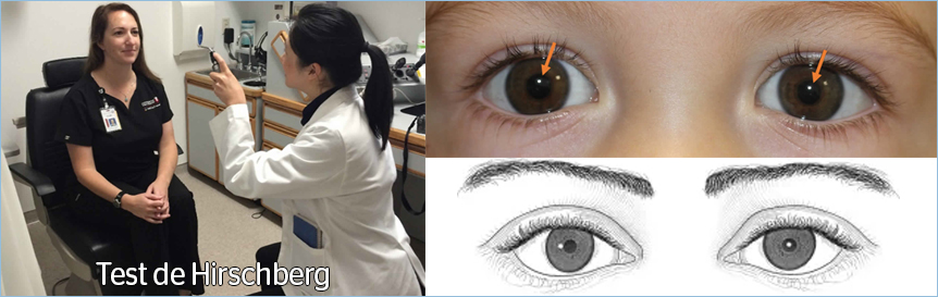 MOTILIDAD OCULAR